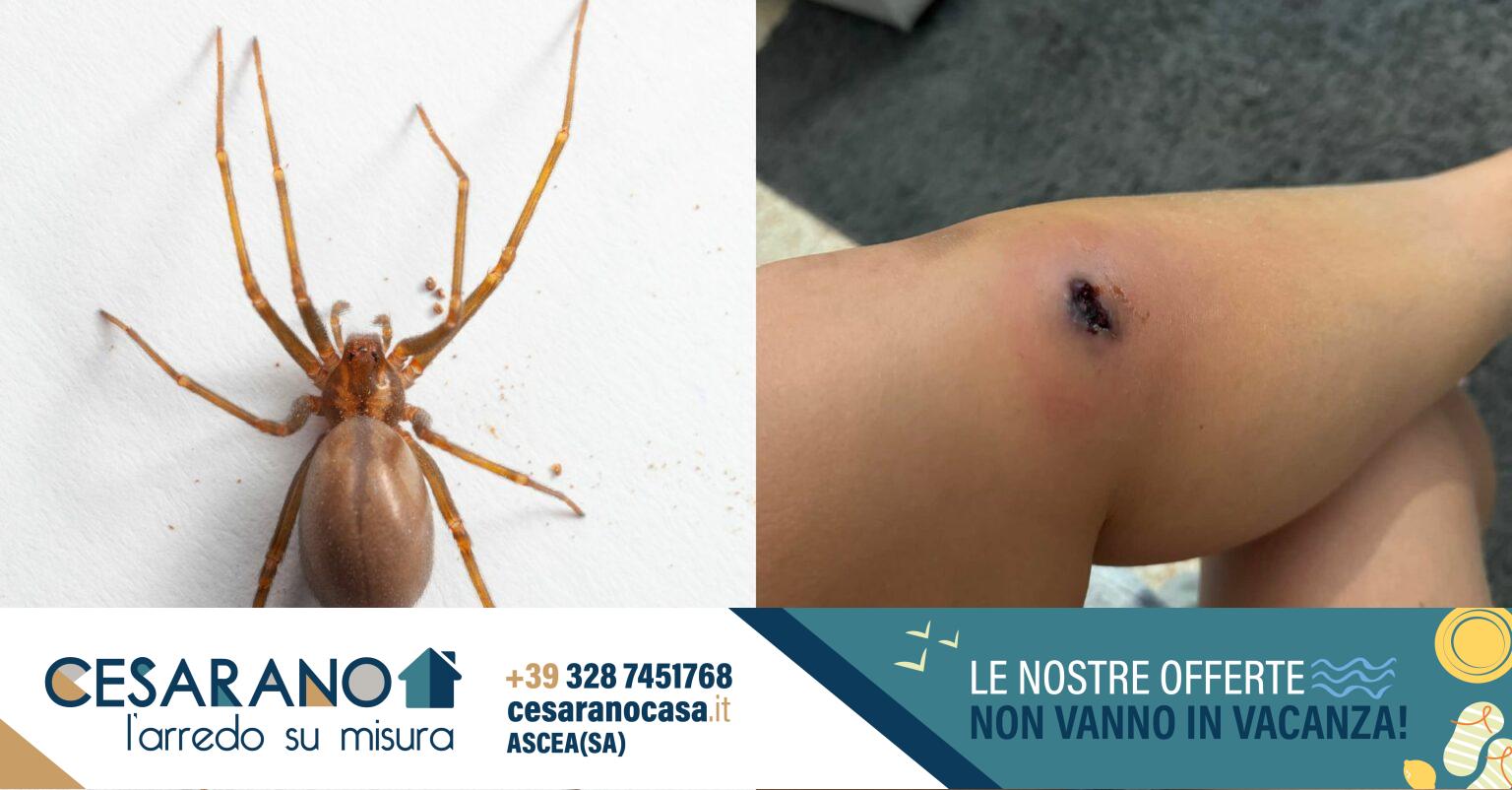 Uomo morso da ragno violino in provincia di Salerno | Giornale del Cilento